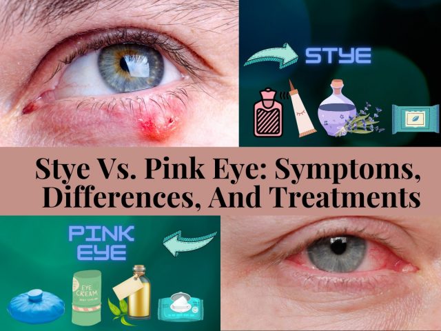 Stye Vs. Pink Eye – Symptoms, Differences, And Treatments – The Goodbye ...